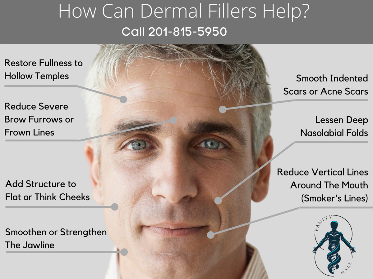 Dermal Fillers for Men in Bergen County NJ - Vanity Male